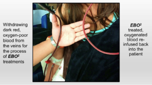 Home - EBO2 Therapy