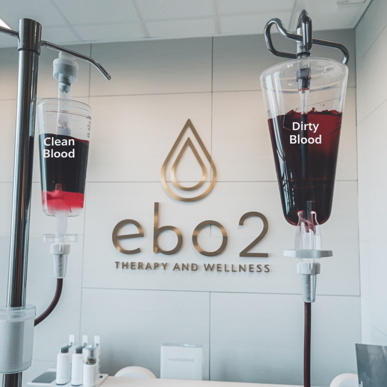 Trusted EBOO Therapy - Rancho Palos Verdes | EBo2 Therapy and Wellness