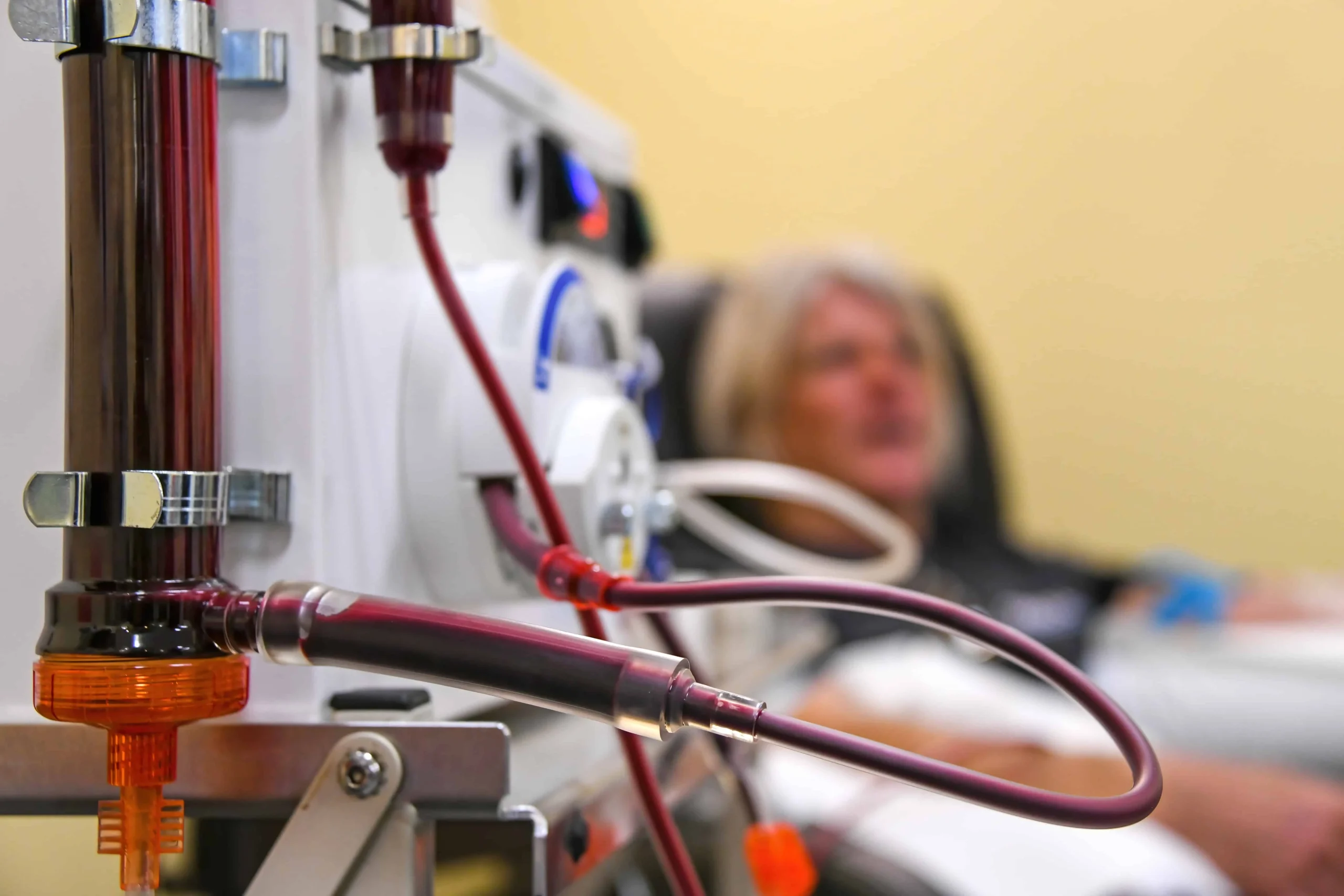 About Us - EBO2 Therapy