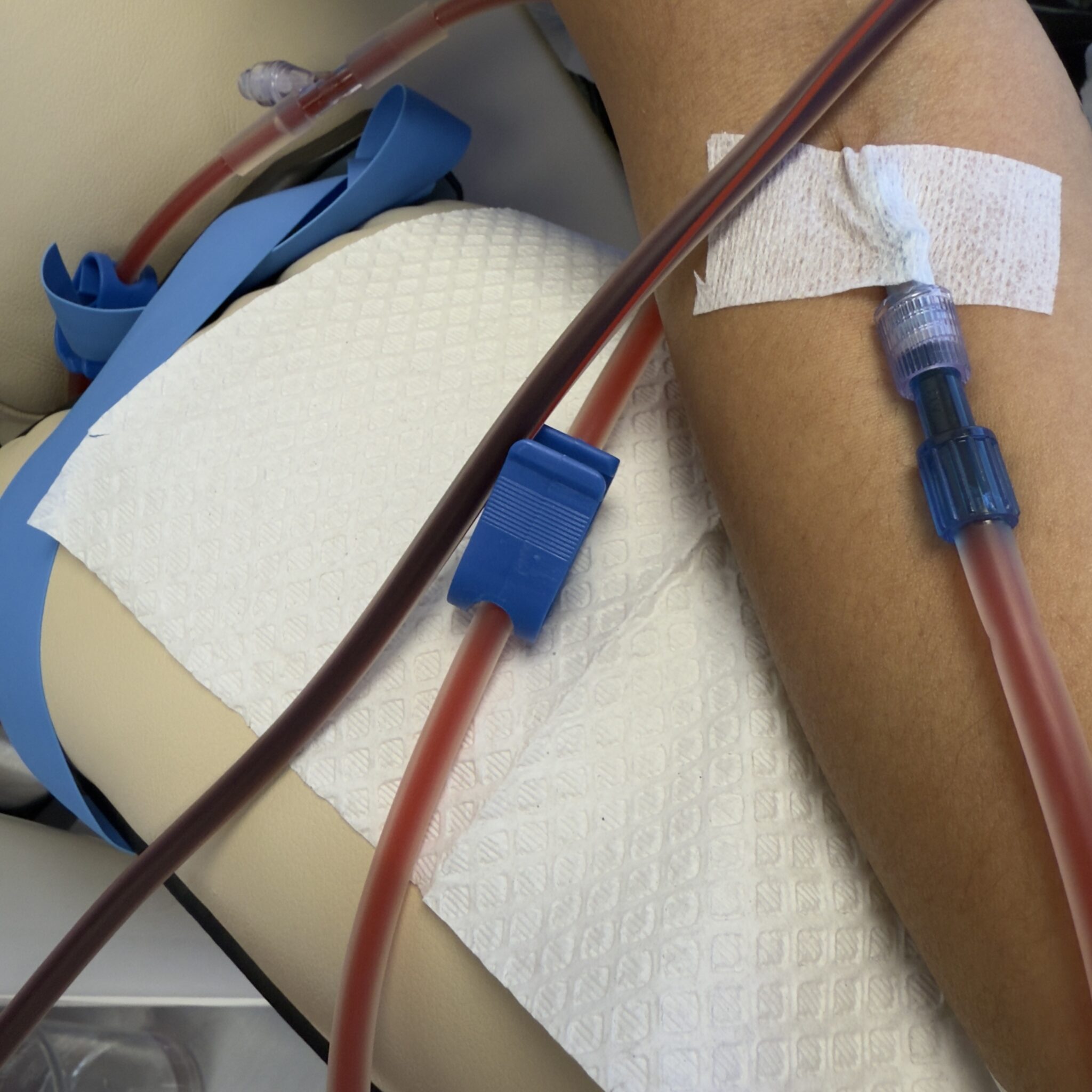 Trusted EBOO Therapy - Rancho Palos Verdes | EBo2 Therapy