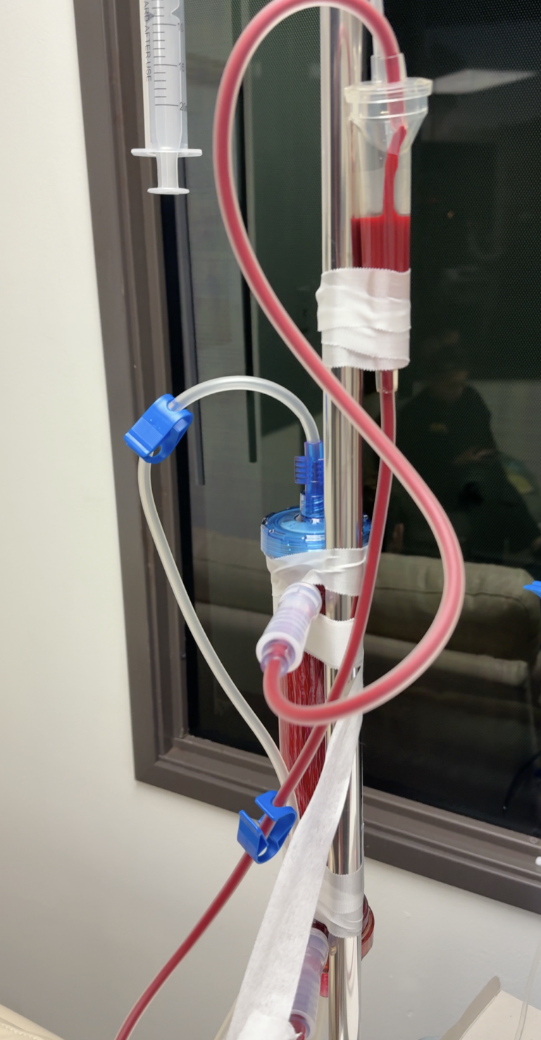 EBOO - EBO2 Therapy And Wellness